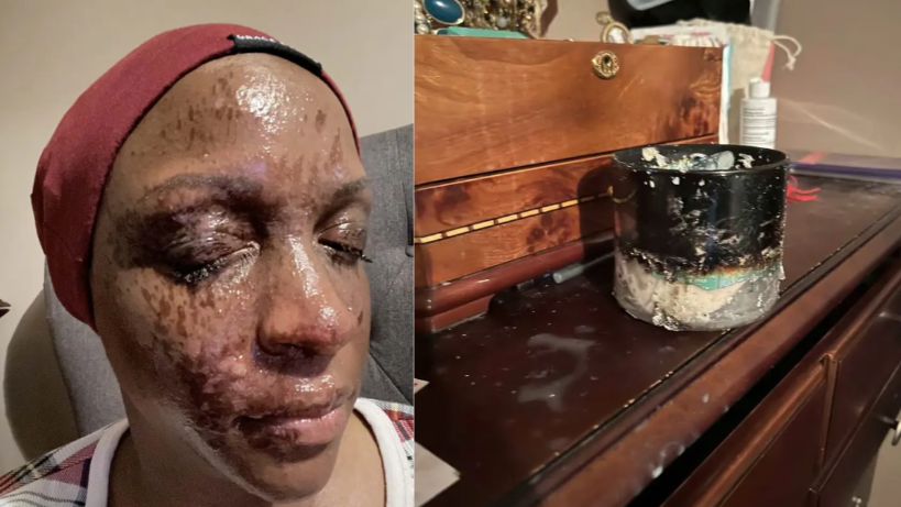 “Shockwave of Fire”: Bath & Body Works Candle Leaves Woman With Severe ...